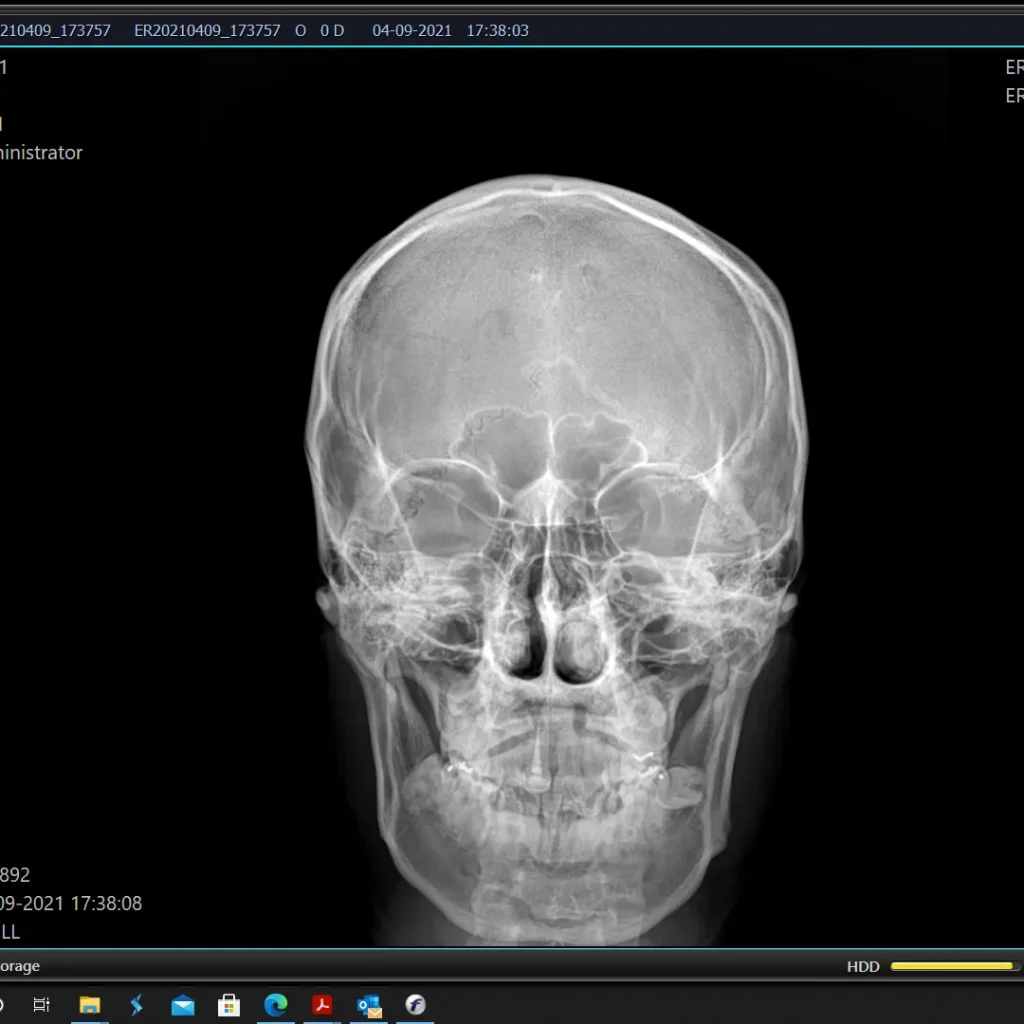 Jumong Retrofit – Wahat alteb
